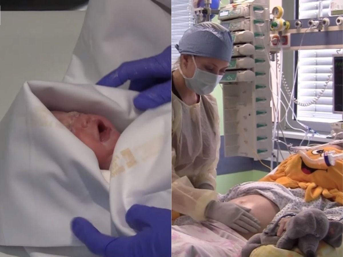 Baby Being Delivered