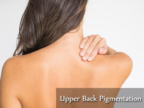 Hyperpigmentation On Back