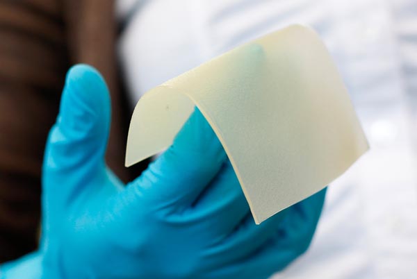 Scientists Have Created Artificial Skin That Can Be Used To Help Burn ...