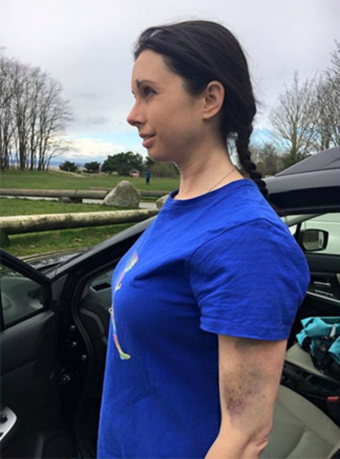 Woman Beat Her Sex Attacker And The Entire Incident Was Recorded On A ...