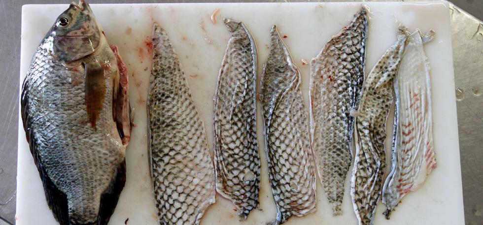 Ingenious Doctors In Brazil Are Using Fish Skin To Help Heal Burn Victims