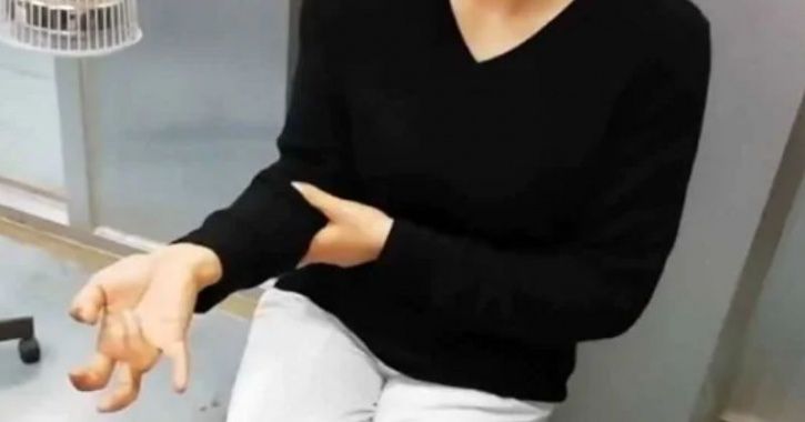 This Chinese Woman Lost All Sensation In Her Fingers After A Week-Long ...