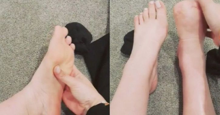 Beauty Treatment Gone Wrong - Woman Loses Toes After A Session Of Fish ...