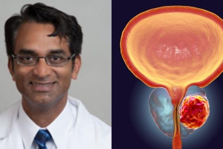 Indian Origin Doctor And His Team Find An Easy Way To Cure Prostate ...