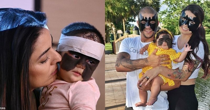 Baby Was Born With A 'Batman Mask' Birthmark, Turns Into Internet's ...
