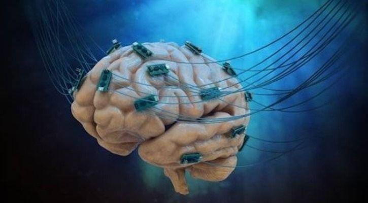 Scientists Want To Help Improve Your Memory With Surgically Implanted