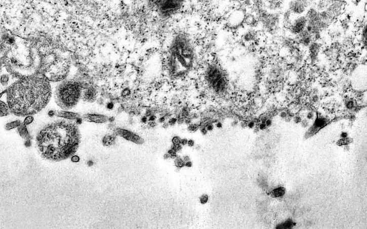 Scientist Capture Exact Moment Coronavirus Infects Cell On Powerful ...