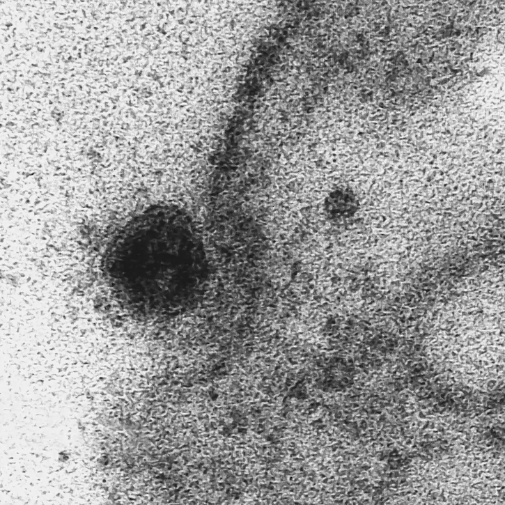 Scientist Capture Exact Moment Coronavirus Infects Cell On Powerful ...