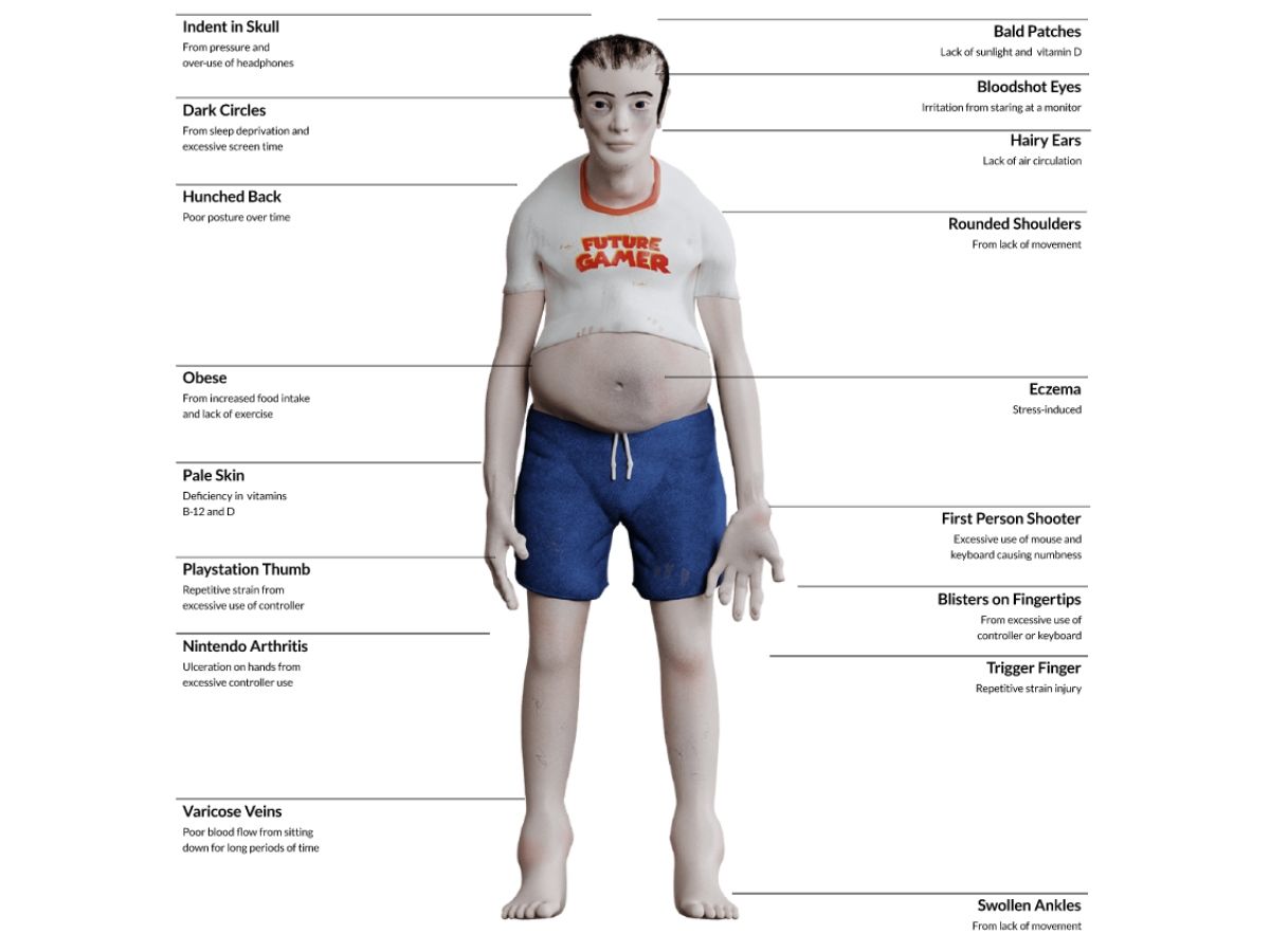 What A Gamer Looks Like In 20 Years, If He Doesn’t Improve His ...