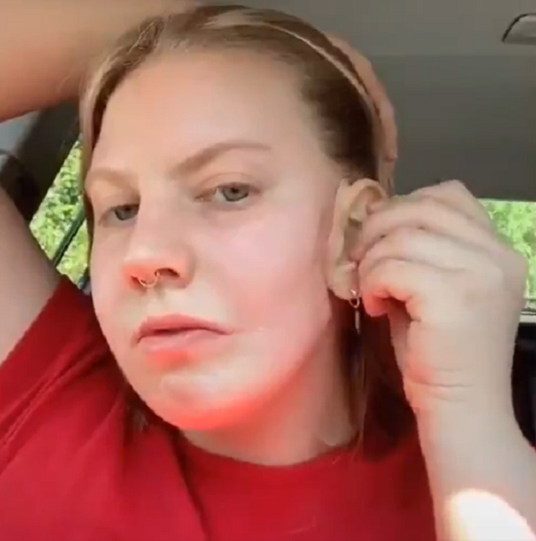 Woman Born With One Ear Shows How To Use A Pop Socket To Wear A Face Mask