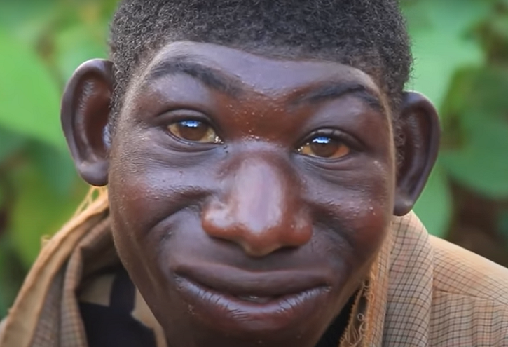 Boy Known As 'Real-Life Mowgli' Gets Bullied