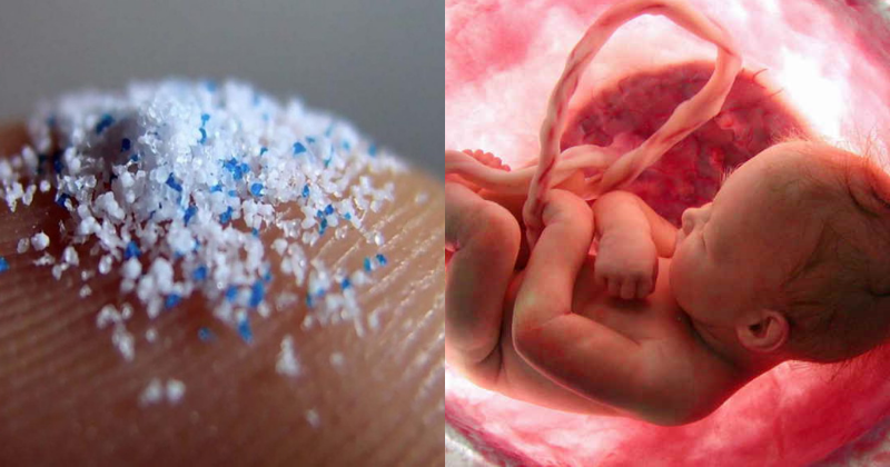 Microplastics Detected In Placentas Of Unborn Babies