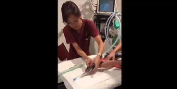 Video Shows Vets Taking Out A Beach Towel That 'Monty' The Python Swallowed