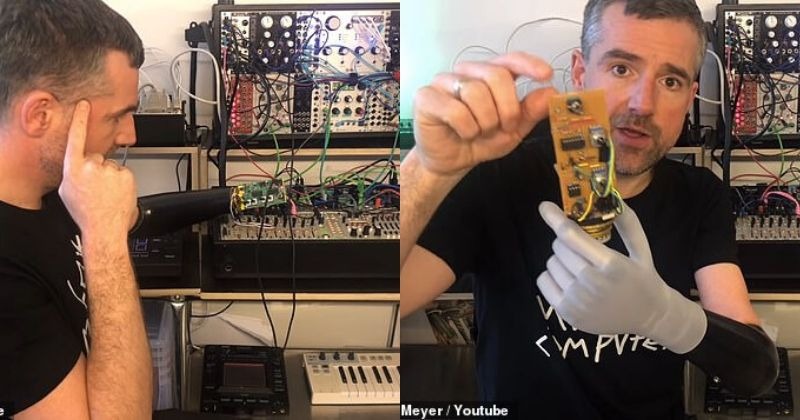 Man Born Without Lower Arm Is Now A DJ & Has Hacked His Prosthetic To ...