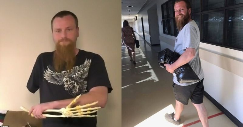 After Losing Arm, Canadian Man Takes The Skeletal Remains Of Amputated ...