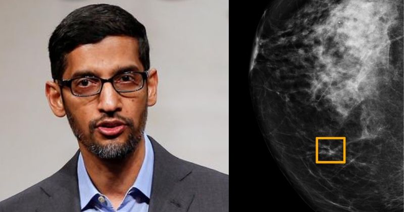 Google Has Built AI That Detects Breast Cancer Faster And Better Than ...