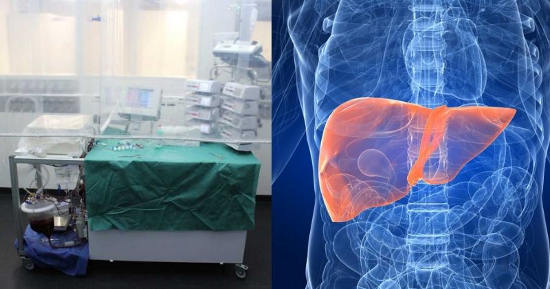 This Machine Can Keep A Sick Liver Alive For A Week, Repair It For ...