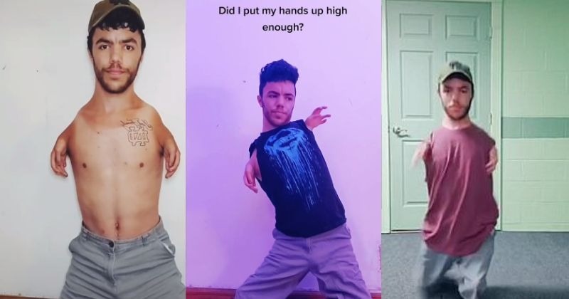 Man With Missing Limbs Now A TikTok Sensation