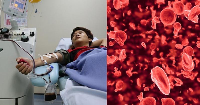 CRISPR Cures Hereditary Disease Needing Regular Blood Transfusion In ...