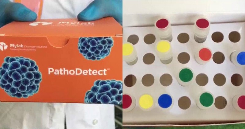 First Indigenously Built Covid-19 Test Kit Gets FDA Approval, Could Be ...