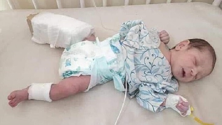 After Getting Shot Twice In The Leg, Newborn Survives The Devastating ...