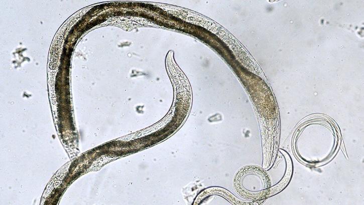 Parasitic Roundworms Seen Moving Inside Man's Stomach