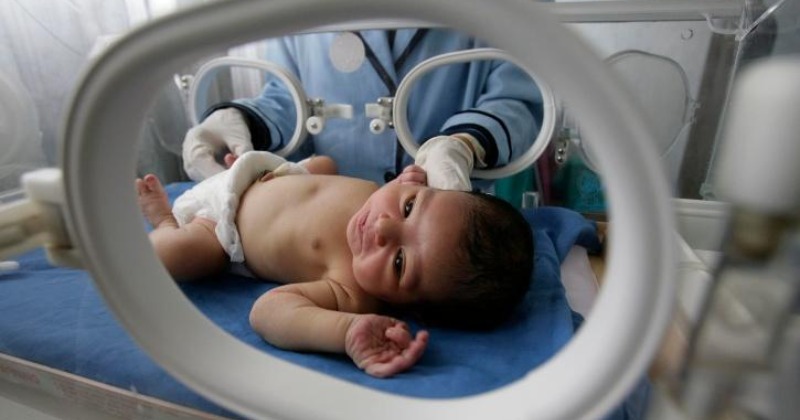 'Microevolution' Sees More People Born Without Wisdom Teeth & With An ...