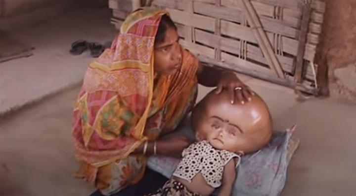 'Rooting For Roona' - The Story Of A Brave Girl Who Fought Against Odds ...