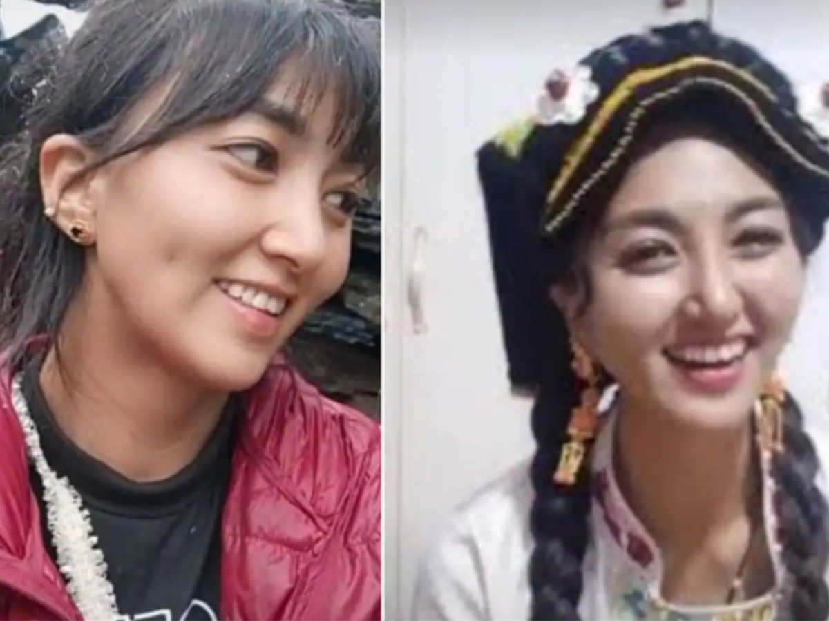 Chinese Social Media Star Burnt By Ex-Husband During Live Stream ...