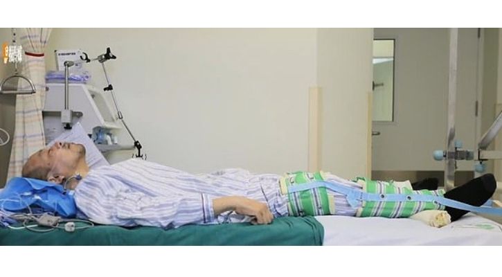 Chinese Man Suffered From Folded Spine, Finally Stands Up After 28 Years