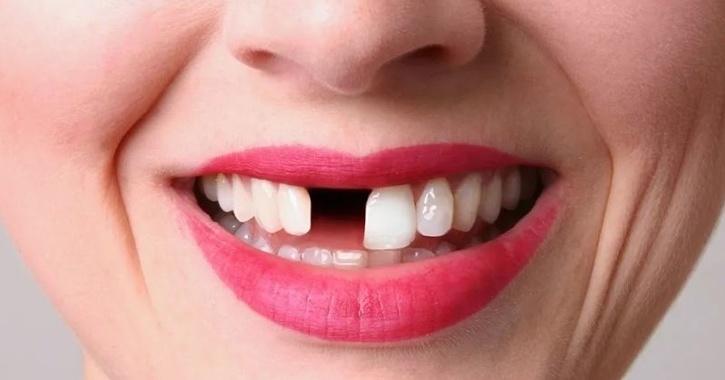 Science Has Found A Way To Fully Regrow Broken Teeth