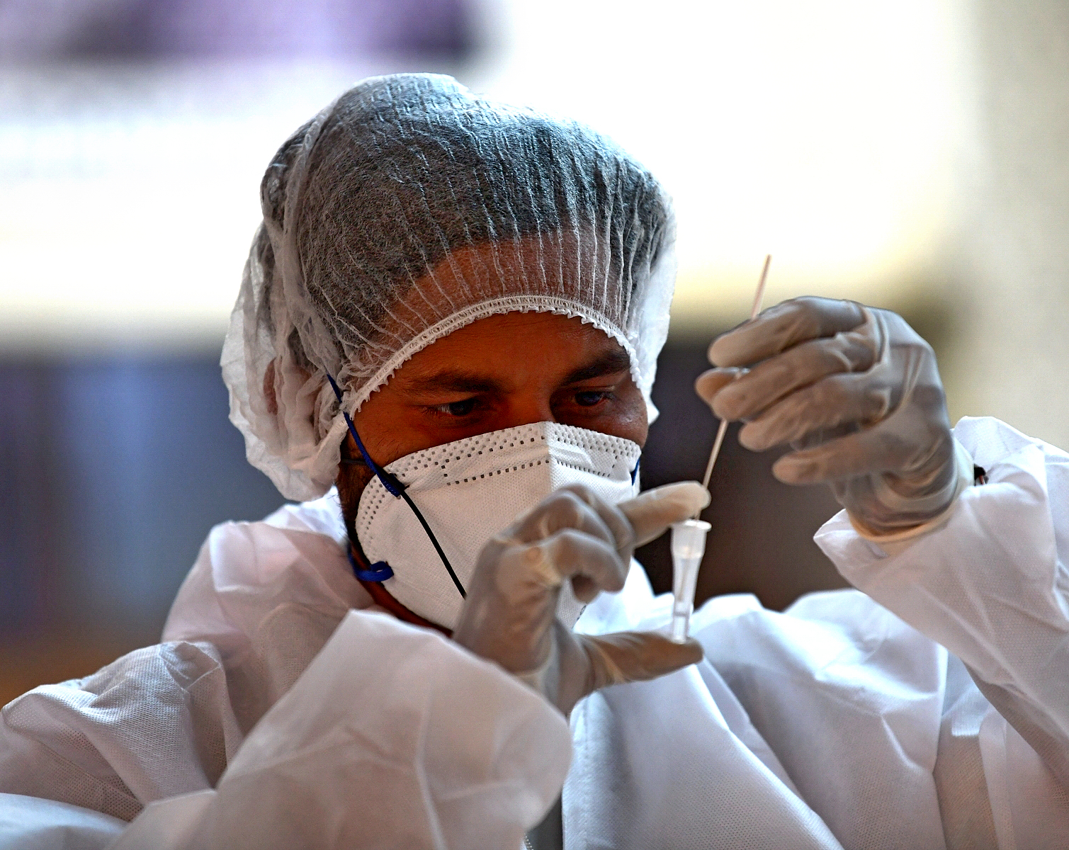 How To Read Your COVID-19 Test Report And What Does CT Value Tell About ...