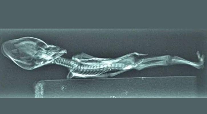 Scientists Solve Mystery Of Bizarre 'Alien' Body Found 18 Years Ago