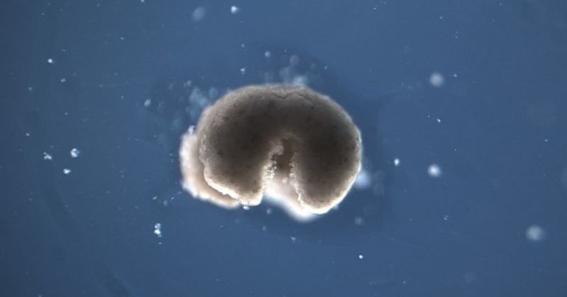 AI-Fuelled Xenobots Are Capable Of Reproduction: But What Is Their Purpose?