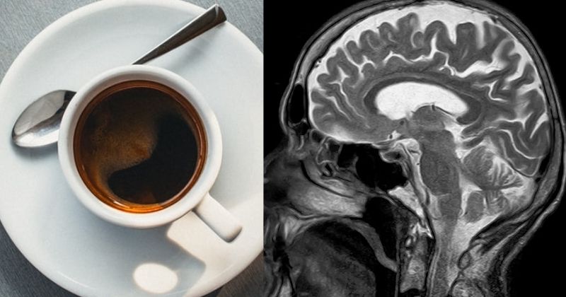 Too Much Caffeine Reduces Level Of Grey Matter In Human Brain