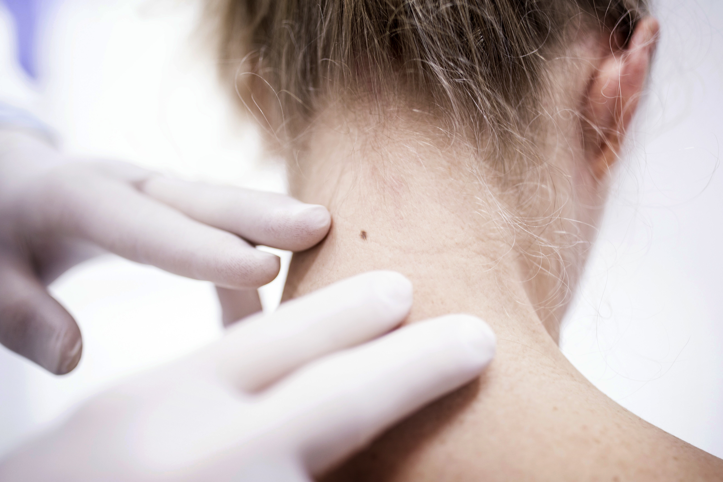 Injection To Treat Skin Cancer