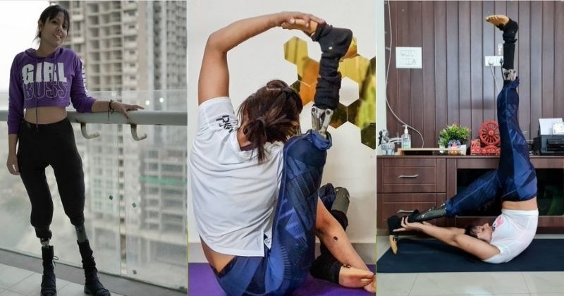 दोनों पैर खो चुकी अर्पिता दुनिया के लिए मिसाल हैं... योग सिखाकर खुश ...