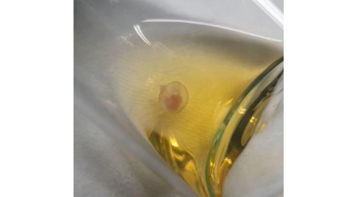 First Time Ever, Scientists Grow Mouse Embryos In An Artificial Womb