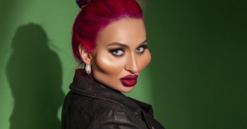 Ukrainian Woman Claims To Have Biggest Cheeks In The World