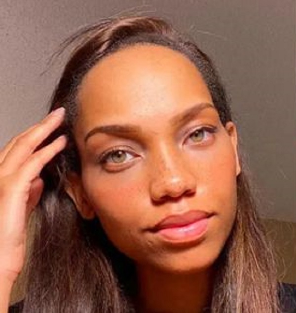 People With No Foreheads