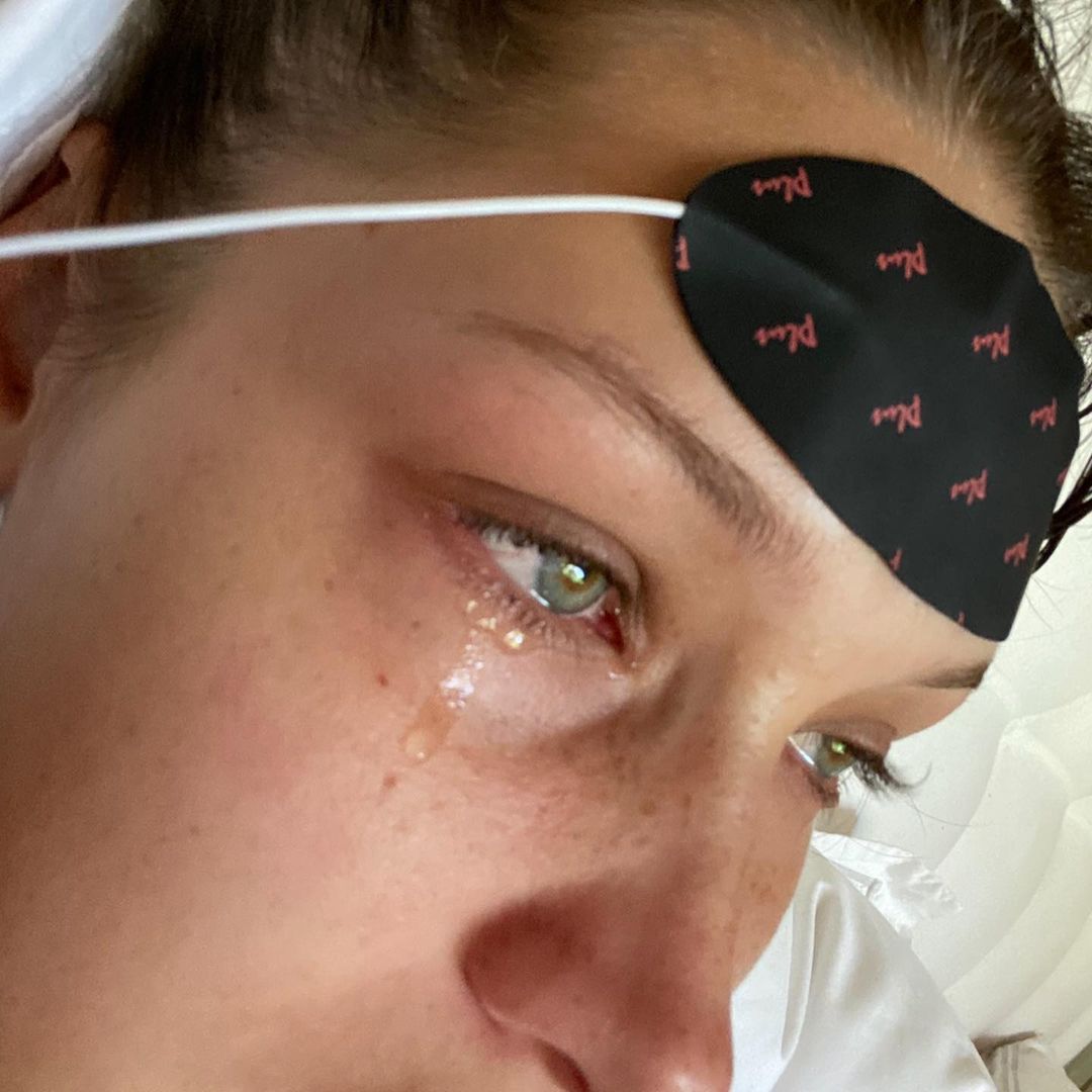 Supermodel Bella Hadid Shares Crying Selfies, Pens A Note On Her Battle ...