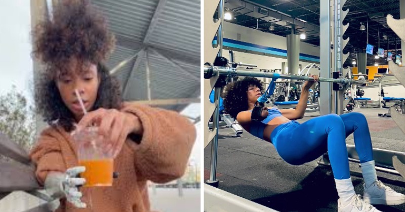 Woman Reveals What Life Is Like With A Bionic Arm