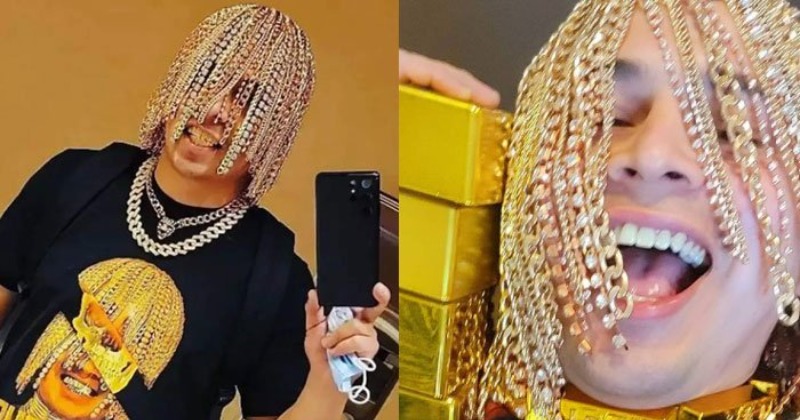 Mexican Rapper Gets Gold chains Surgically Implanted In Scalp!