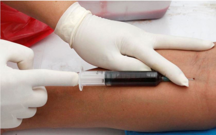 What Is Chicken Blood Therapy?