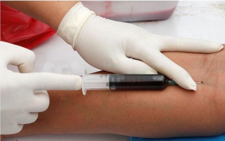 What Is Chicken Blood Therapy?