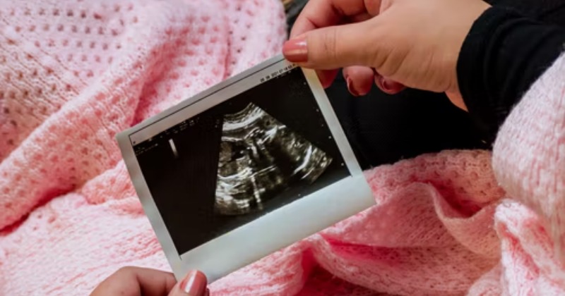 Explained: Common Myths And Misconceptions About IVF Explained: Common Myths And Misconceptions About IVF