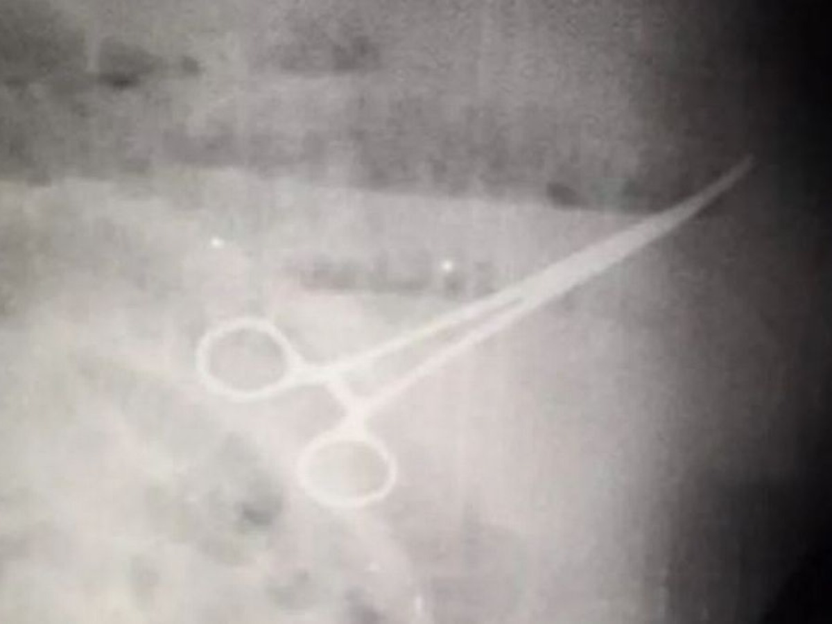 Patient Dies After Surgeons Leave Scissors Inside Stomach