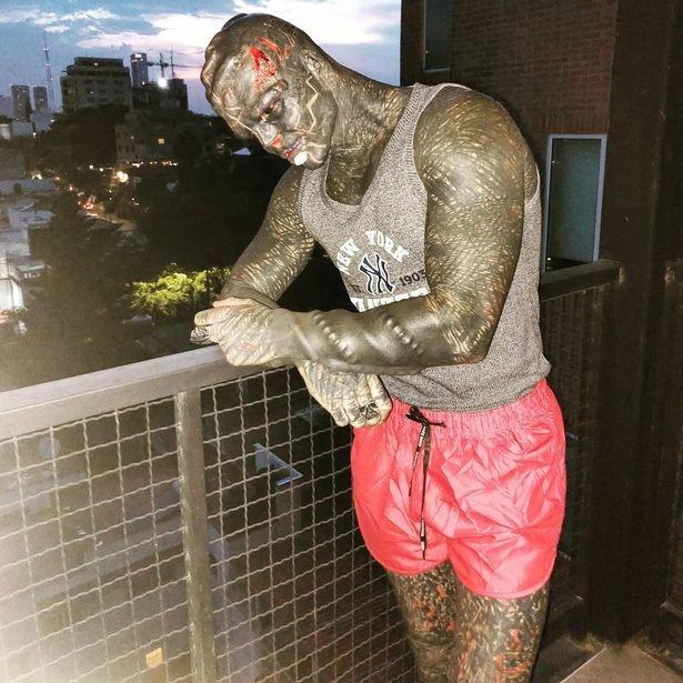 'Black Alien' Has Flesh Carved Out Of Head To Spell Nickname