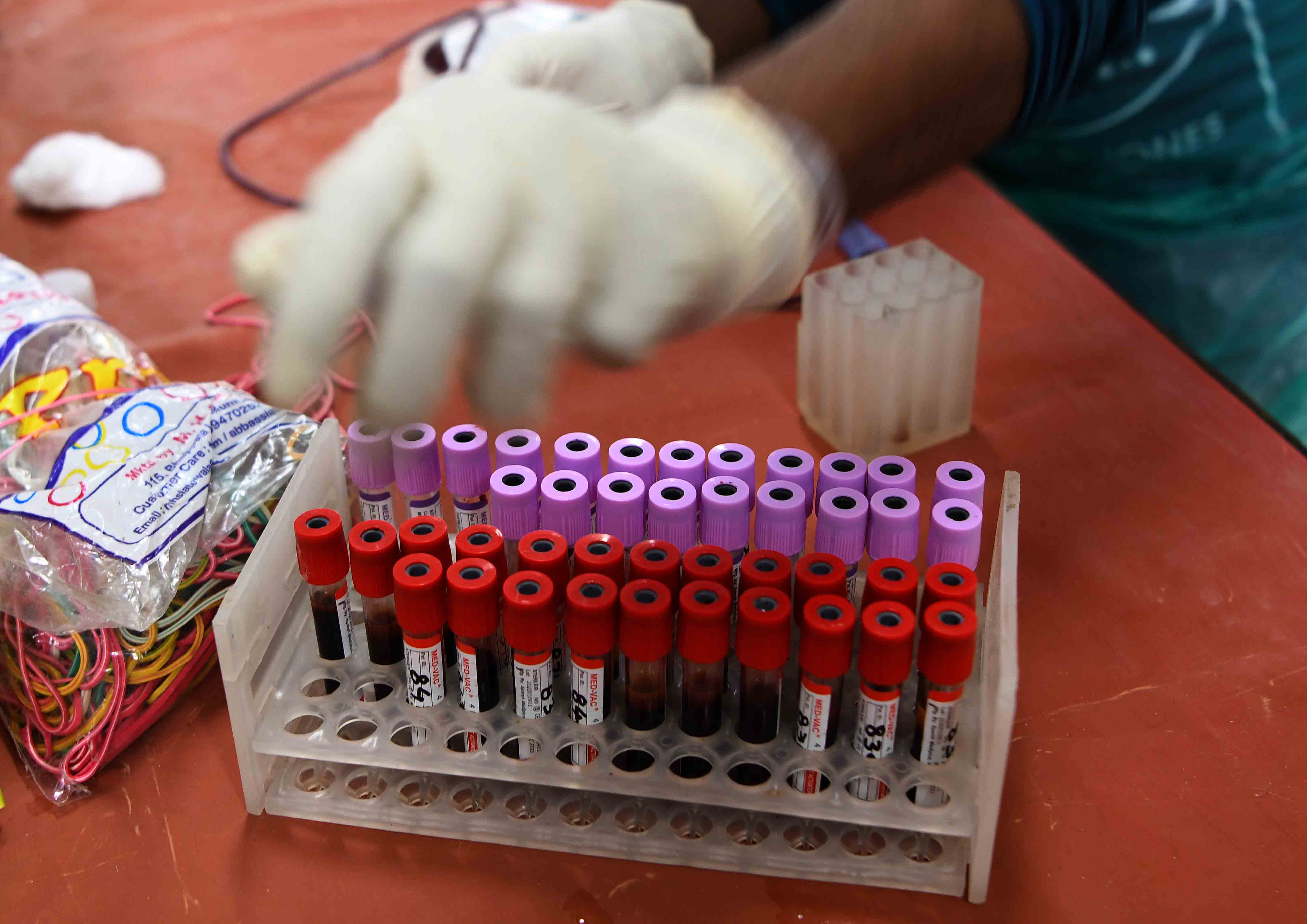 From January 1, Residents Of Delhi Can Avail 450 Medical Tests For Free