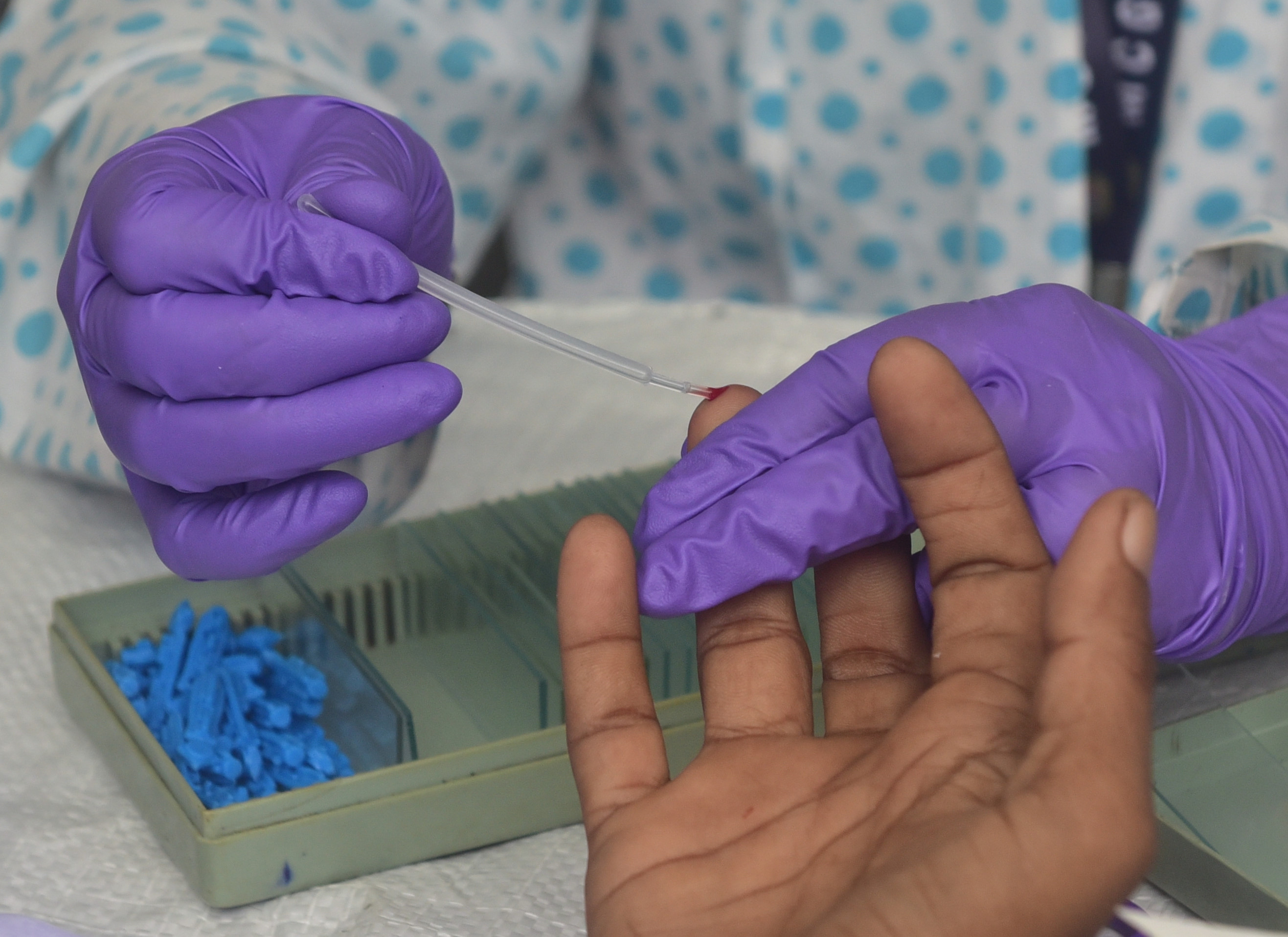 From January 1, Residents Of Delhi Can Avail 450 Medical Tests For Free